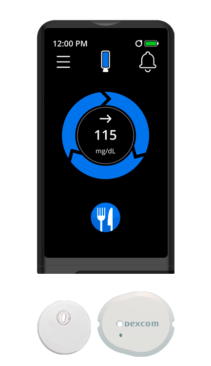 Introducing the iLet Bionic Pancreas